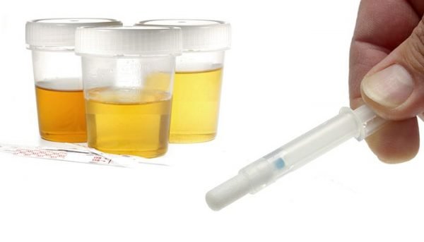 Urine drug testing ‘fake pee’ on the rise